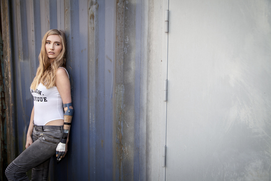 Kelly Knox was born without her lower left arm, and throughout her life ...